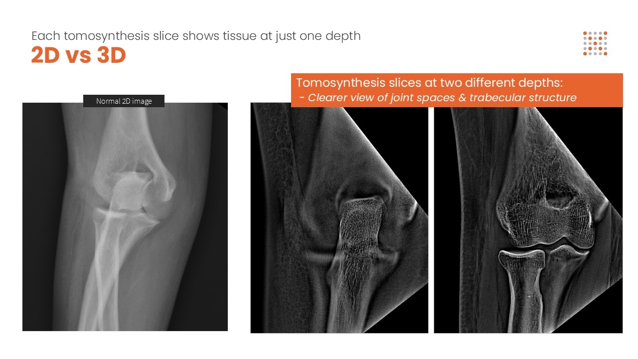 USING HIGH-POWER COMPUTING TO ENABLE BEDSIDE 3D CHEST IMAGING ...